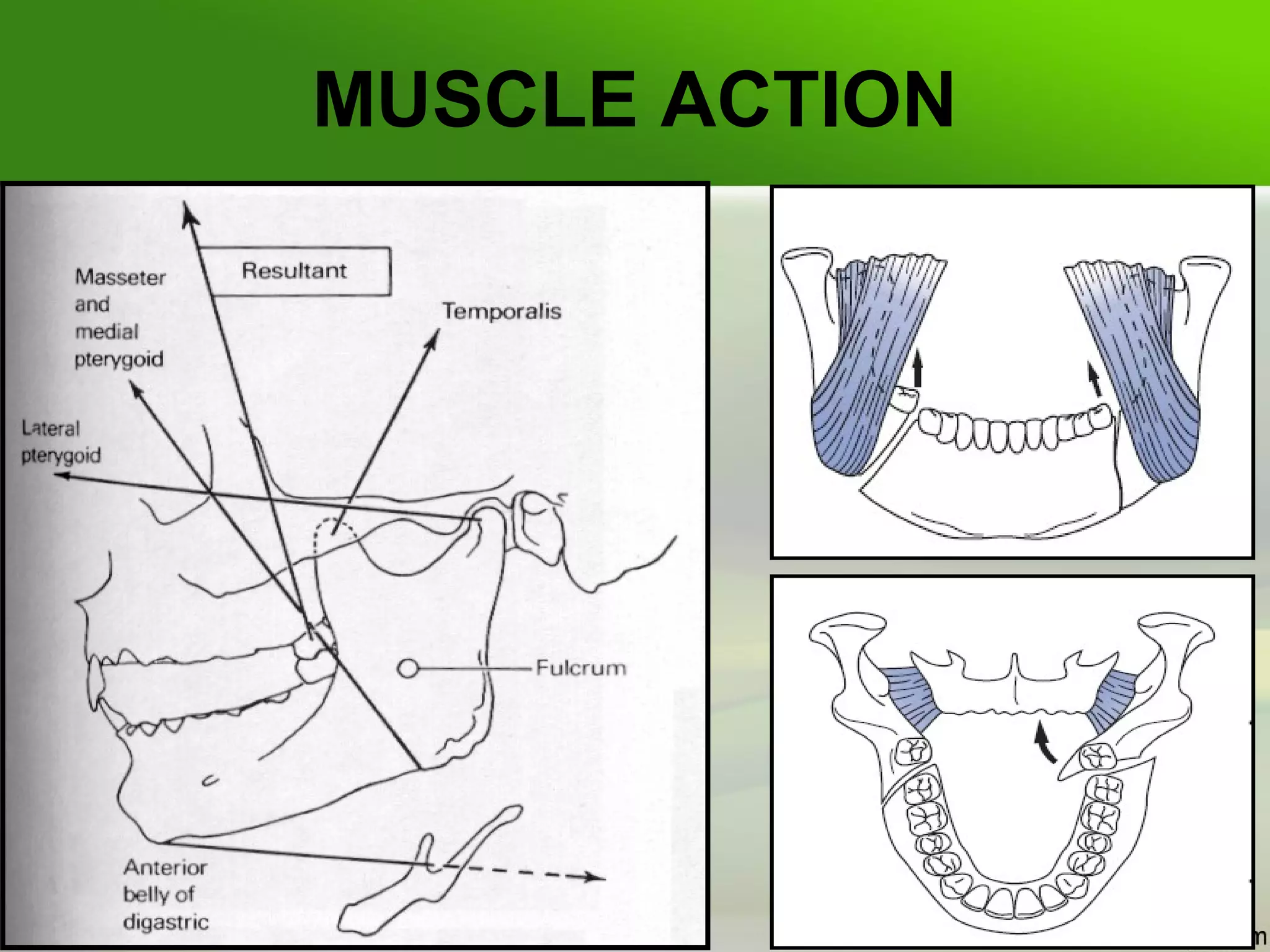 Case of trauma(Mandibular Left Parasymphysis and Right Angle Fracture ...