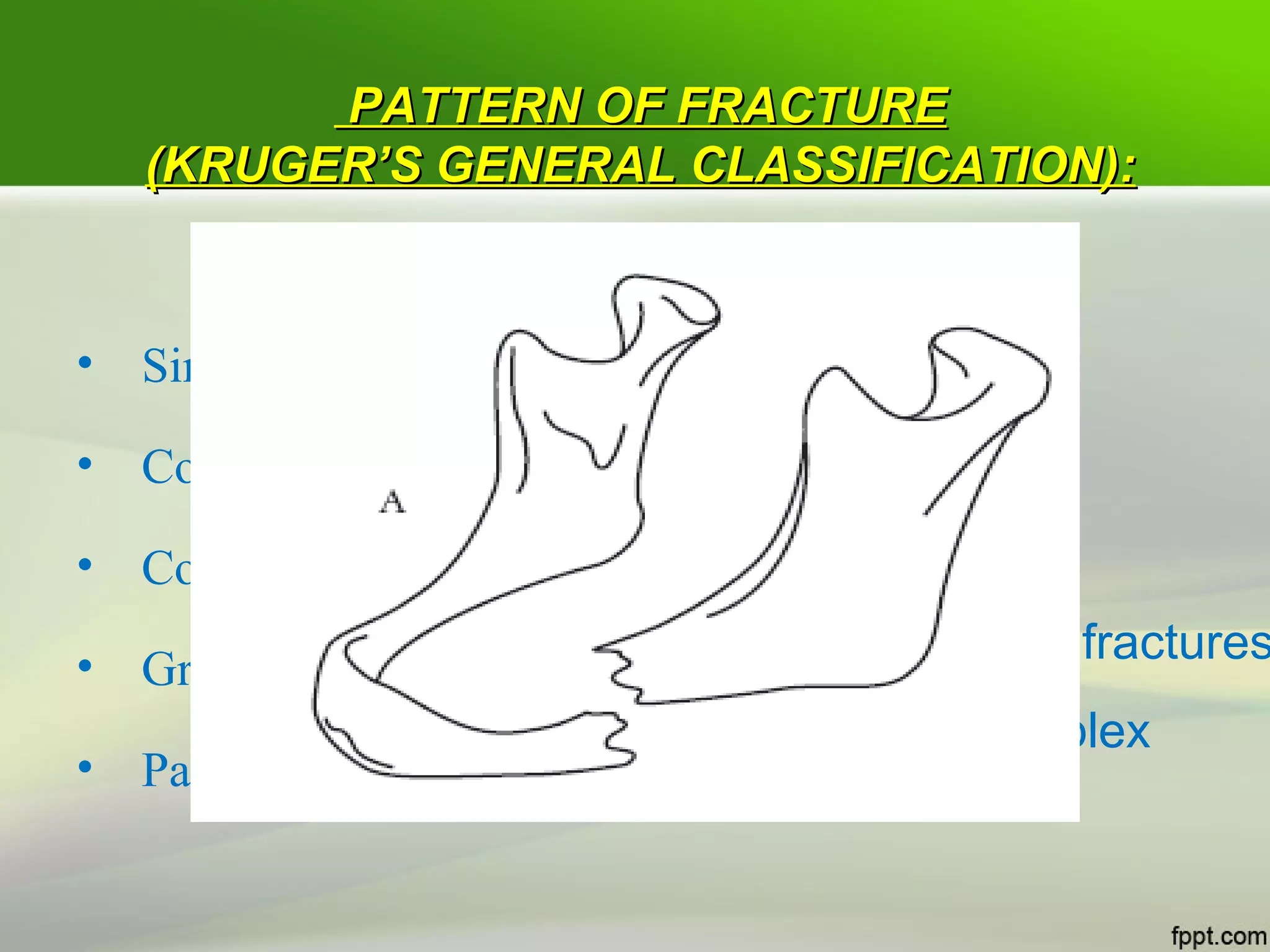 Case of trauma(Mandibular Left Parasymphysis and Right Angle Fracture ...