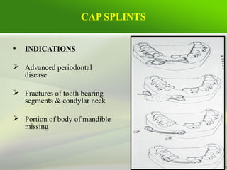 Case of trauma(Mandibular Left Parasymphysis and Right Angle Fracture ...