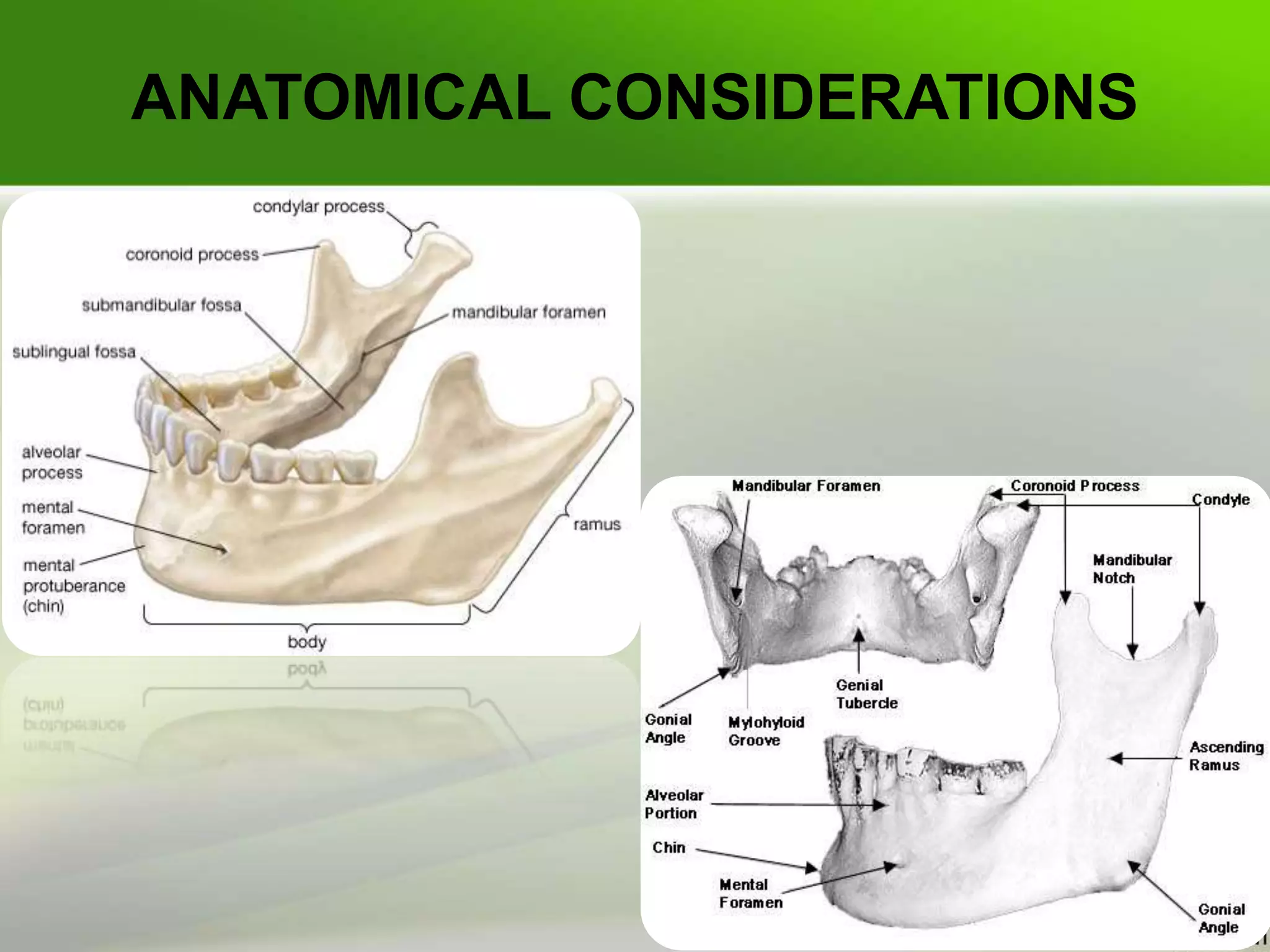 Case of mandibular parasymphysis and angle fracture | PPT | Death ...