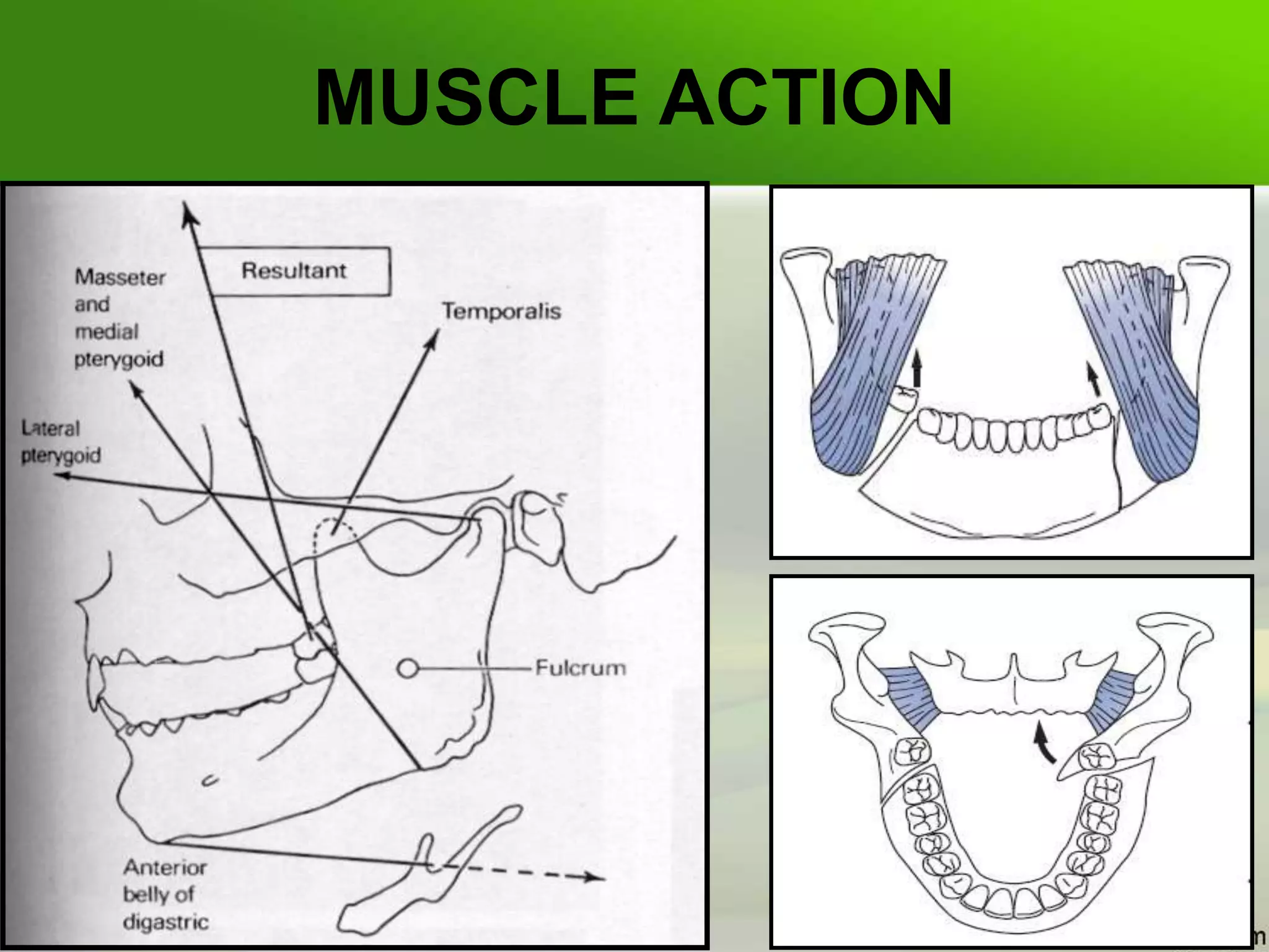 Case of mandibular parasymphysis and angle fracture | PPT | Death ...