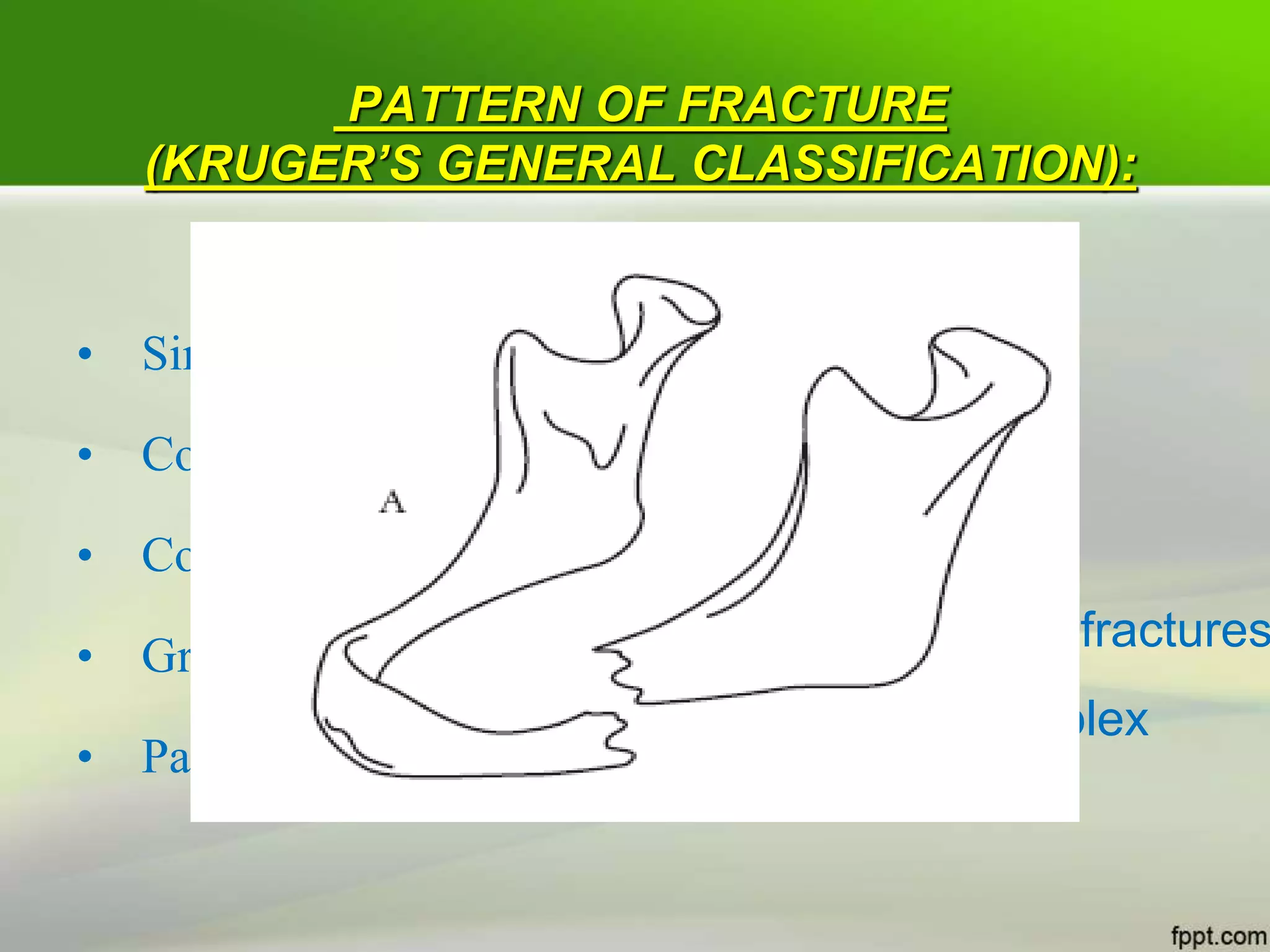 Case of mandibular parasymphysis and angle fracture | PPT | Death ...