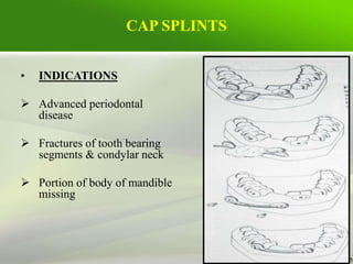 Case of mandibular parasymphysis and angle fracture | PPT