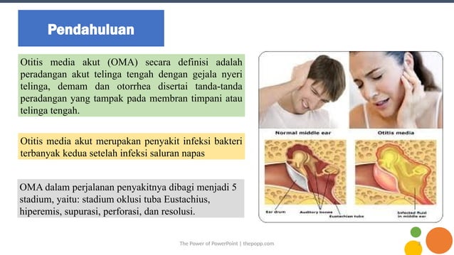 LAPORAN KASUS ILMU THT OTITIS MEDIA AKUT.pptx