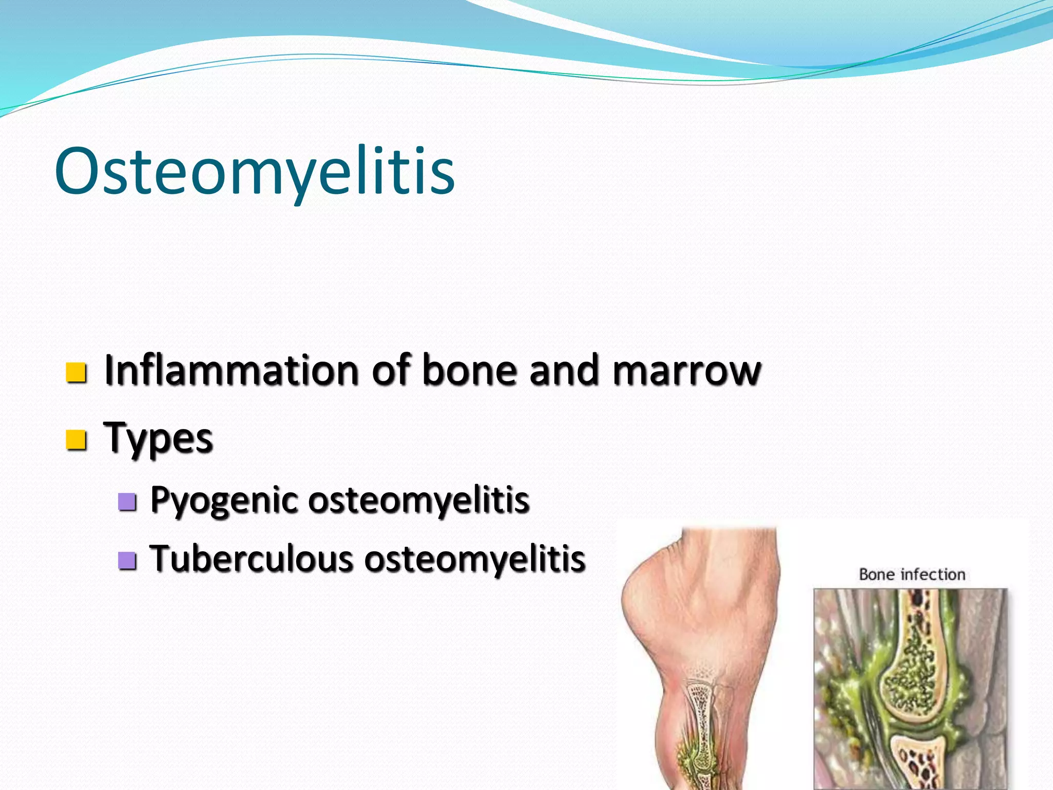 Case on osteomyelitis (shahnawaz) | PPTX