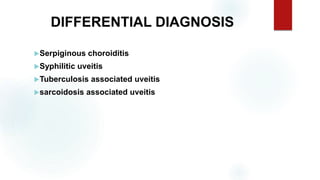 A case presentation on posterior uveitis | PPTX