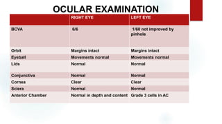 A case presentation on posterior uveitis | PPTX