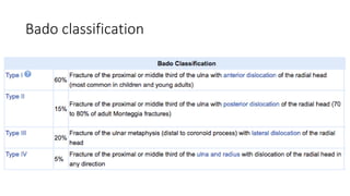 Caseortho ext.bodin | PPT
