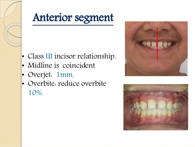 Dr-Ali Alseyani Case persentation