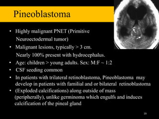 pineal germinoma CASE | PPTX
