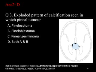 pineal germinoma CASE | PPTX