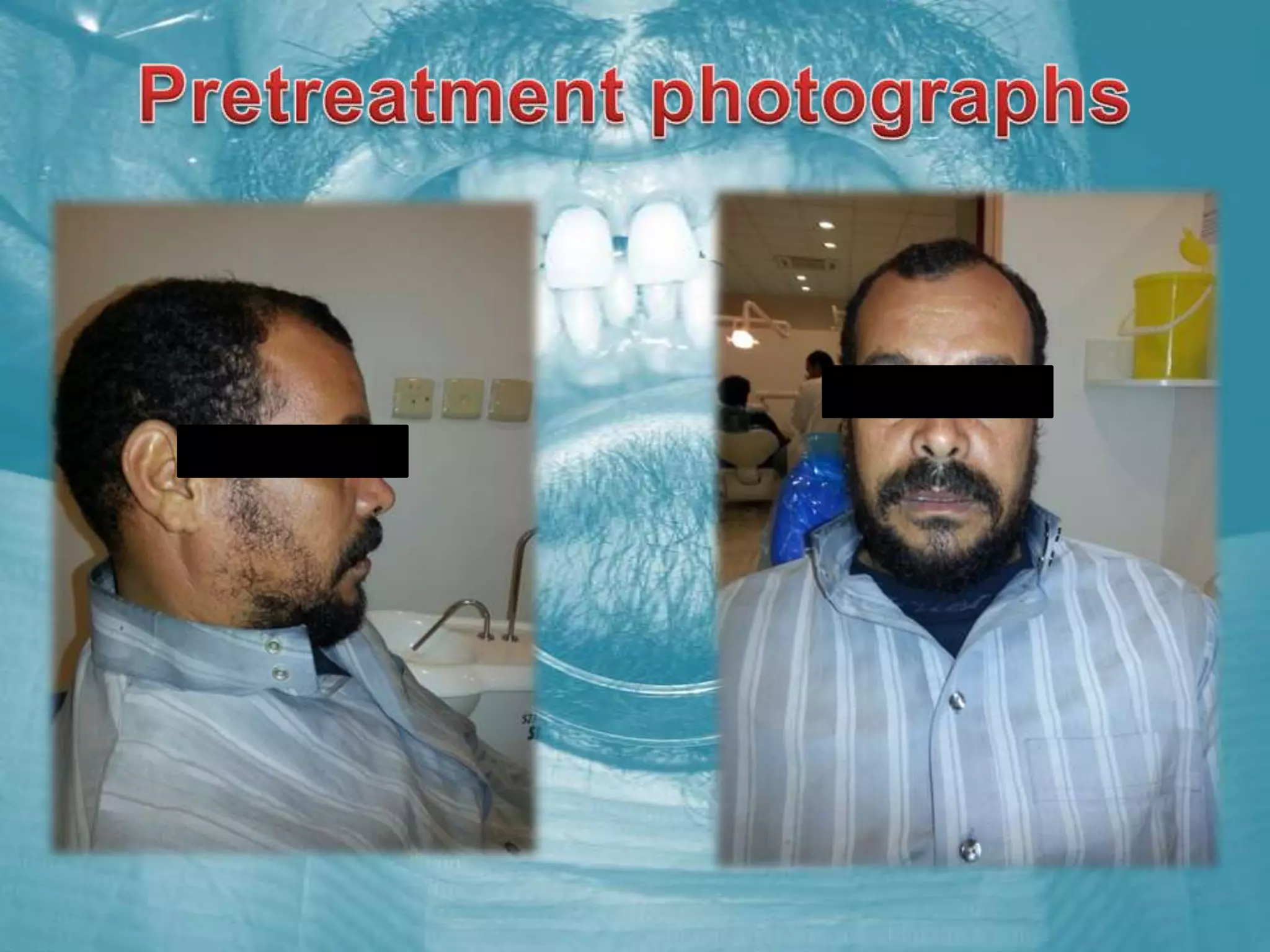 Case presentation " Treatment Plan " | PPSX