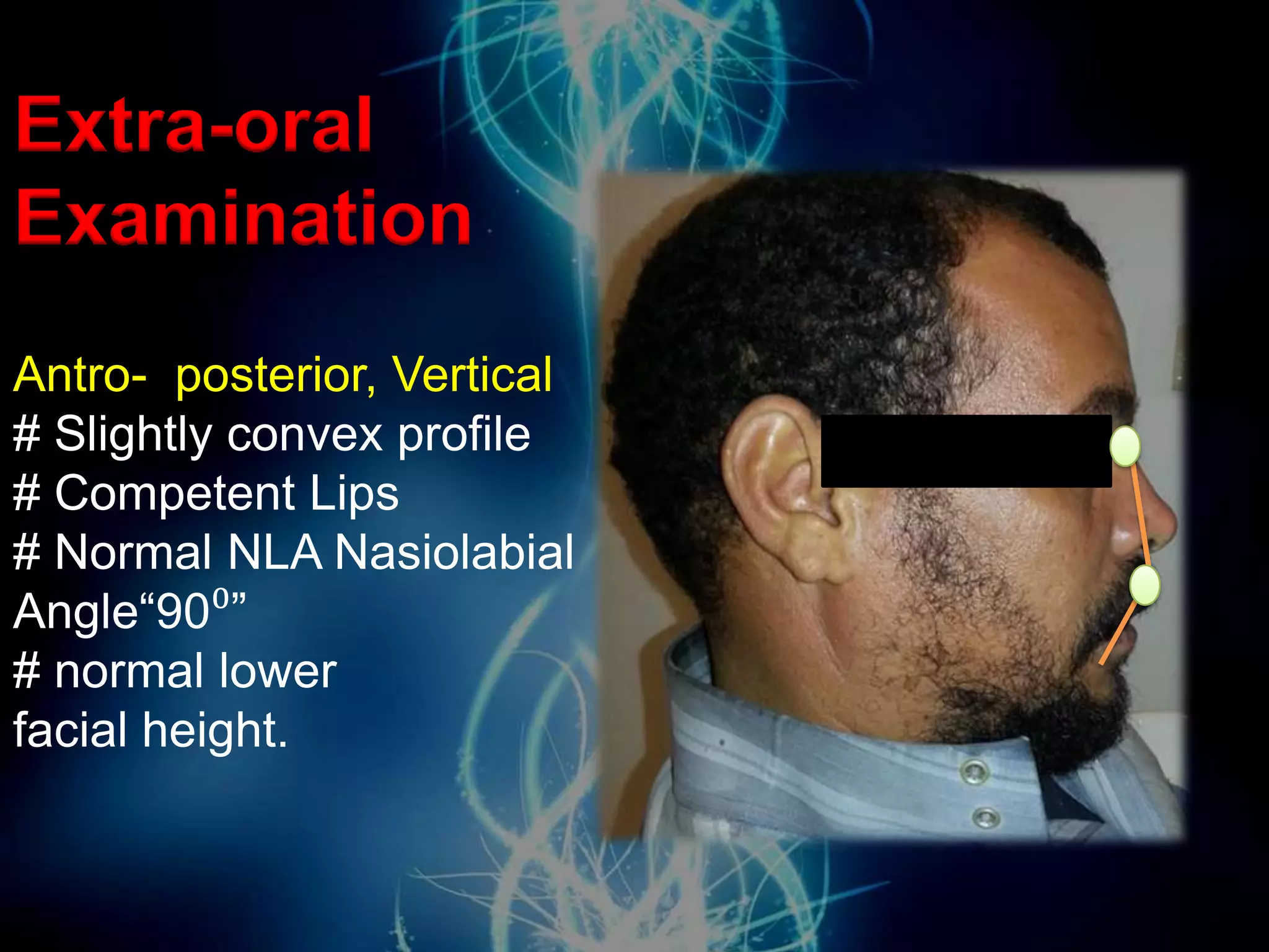 Case presentation " Treatment Plan " | PPSX