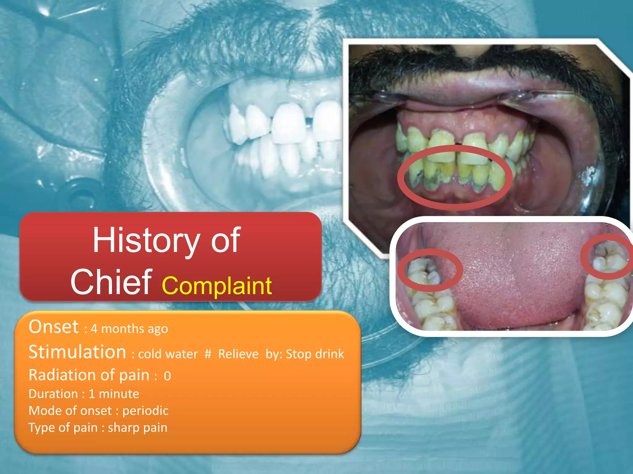 Case presentation " Treatment Plan " | PPSX