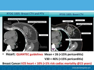Case Based Early Breast Cancer- Role of Radiotherapy | PPTX
