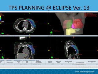 Case Based Early Breast Cancer- Role of Radiotherapy | PPTX
