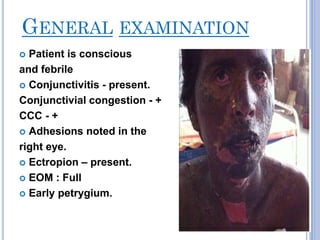 Case presentation on toxic epidermal necrolysis | PPTX