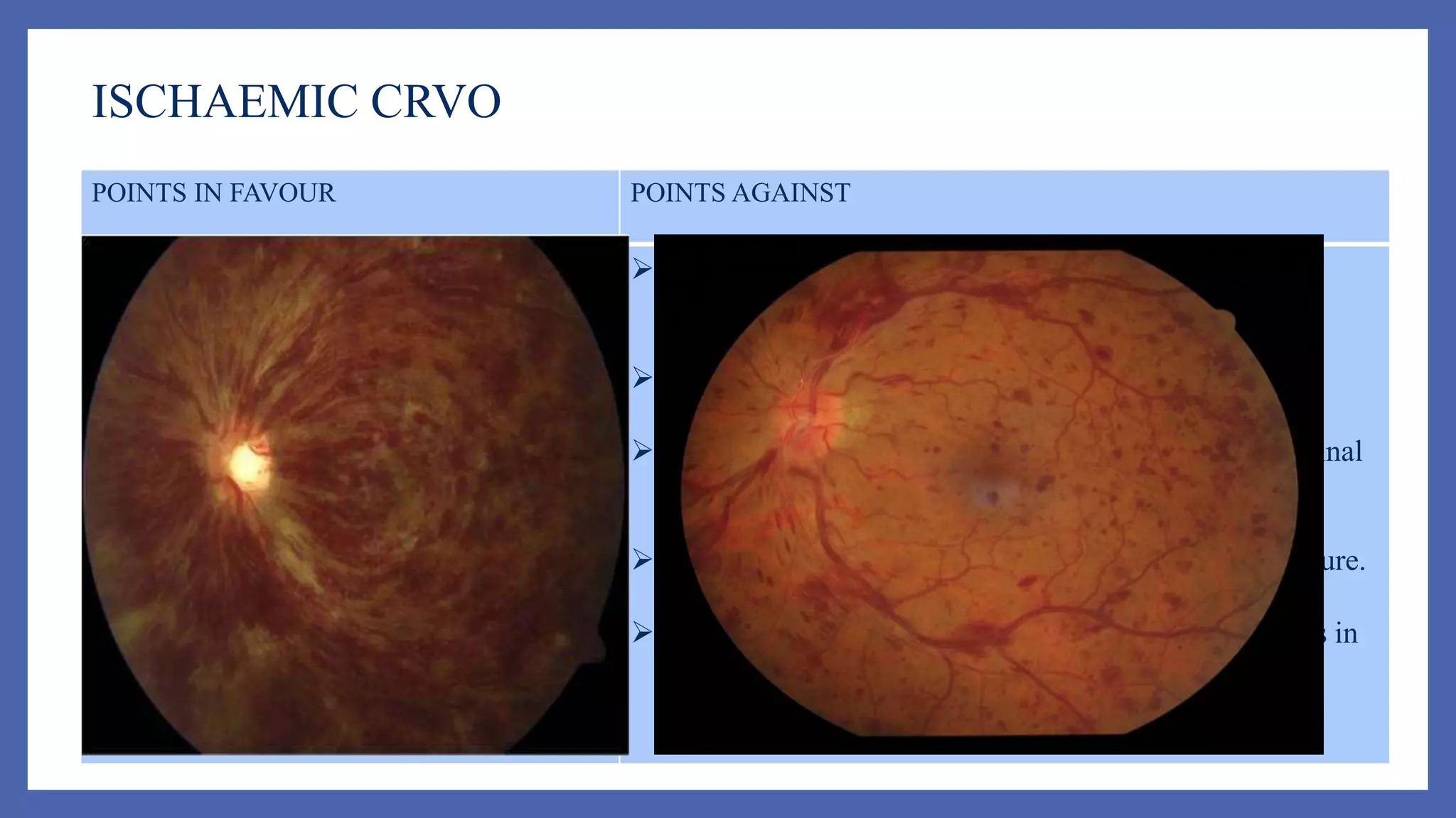 Crvo case presentation.pptx