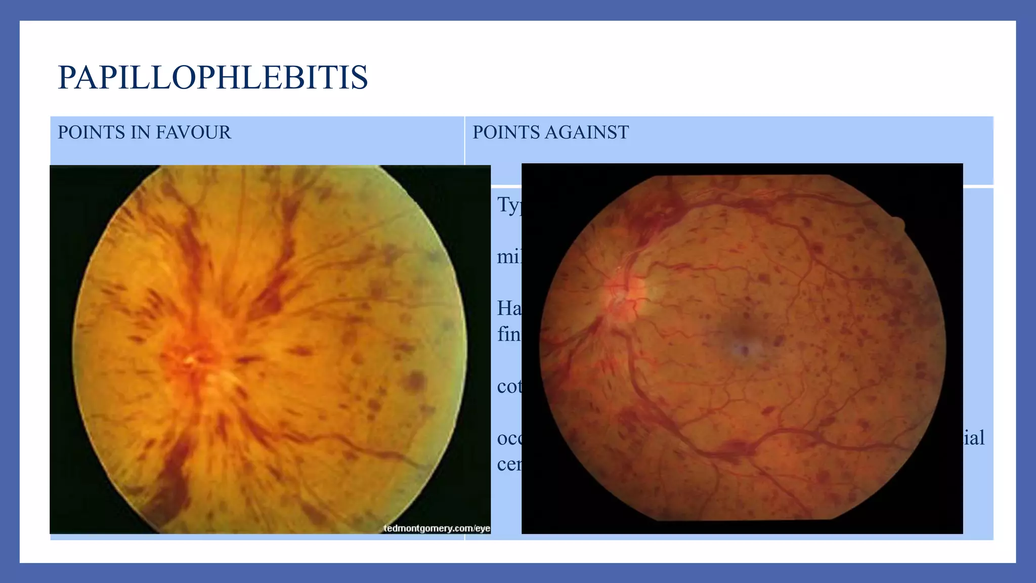 Crvo case presentation.pptx