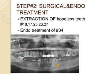 Dental Management of Epileptic Patient (with case study) | PPTX