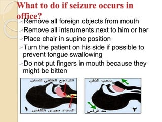 Dental Management of Epileptic Patient (with case study) | PPTX