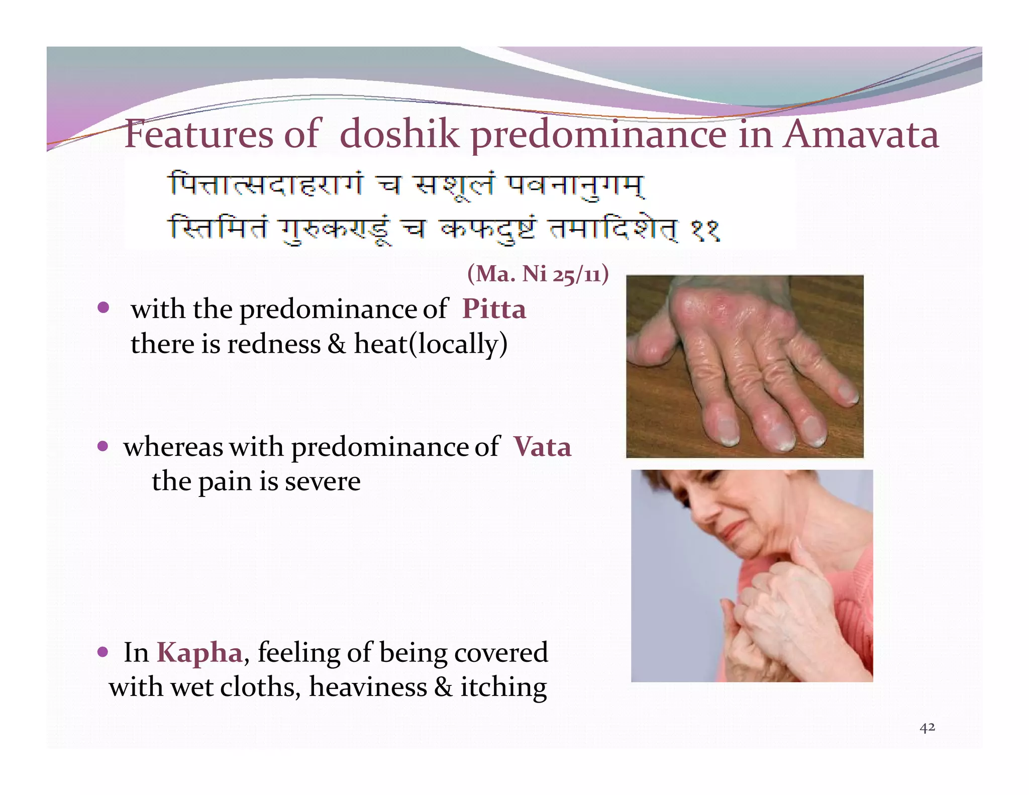 Clinical Presentation on Rheumatoid Arthritis (Amavata) | PDF