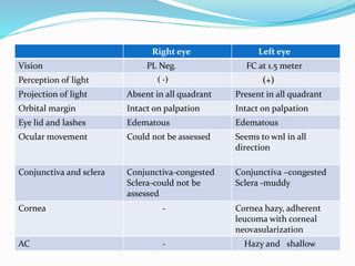 Case presentaion- Kerato-uveitis-Dr. Vijay pratap singh | PPTX