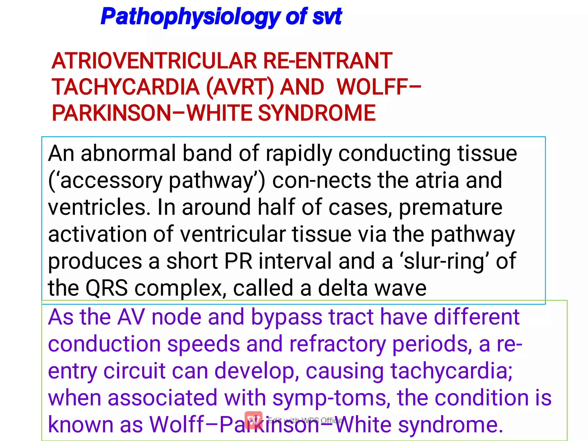 Supraventricular tachycardia | PDF