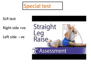 Lumbar radiculopathy and SI joint dysfunction | PPTX