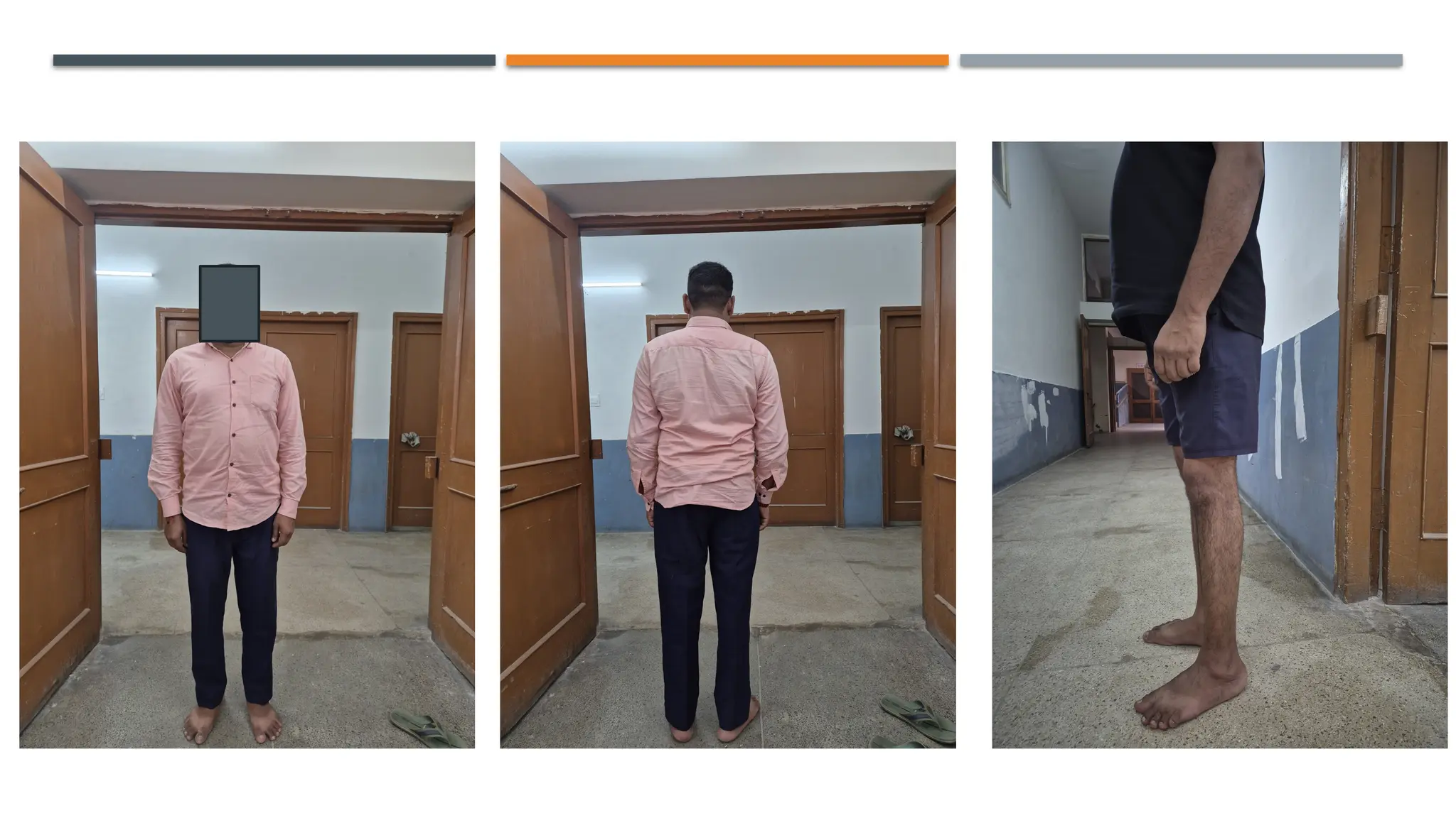 Orthopeadic Physiotherapy Assesment Dr. Sachin.pptx