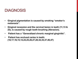 Case presentation | PPT