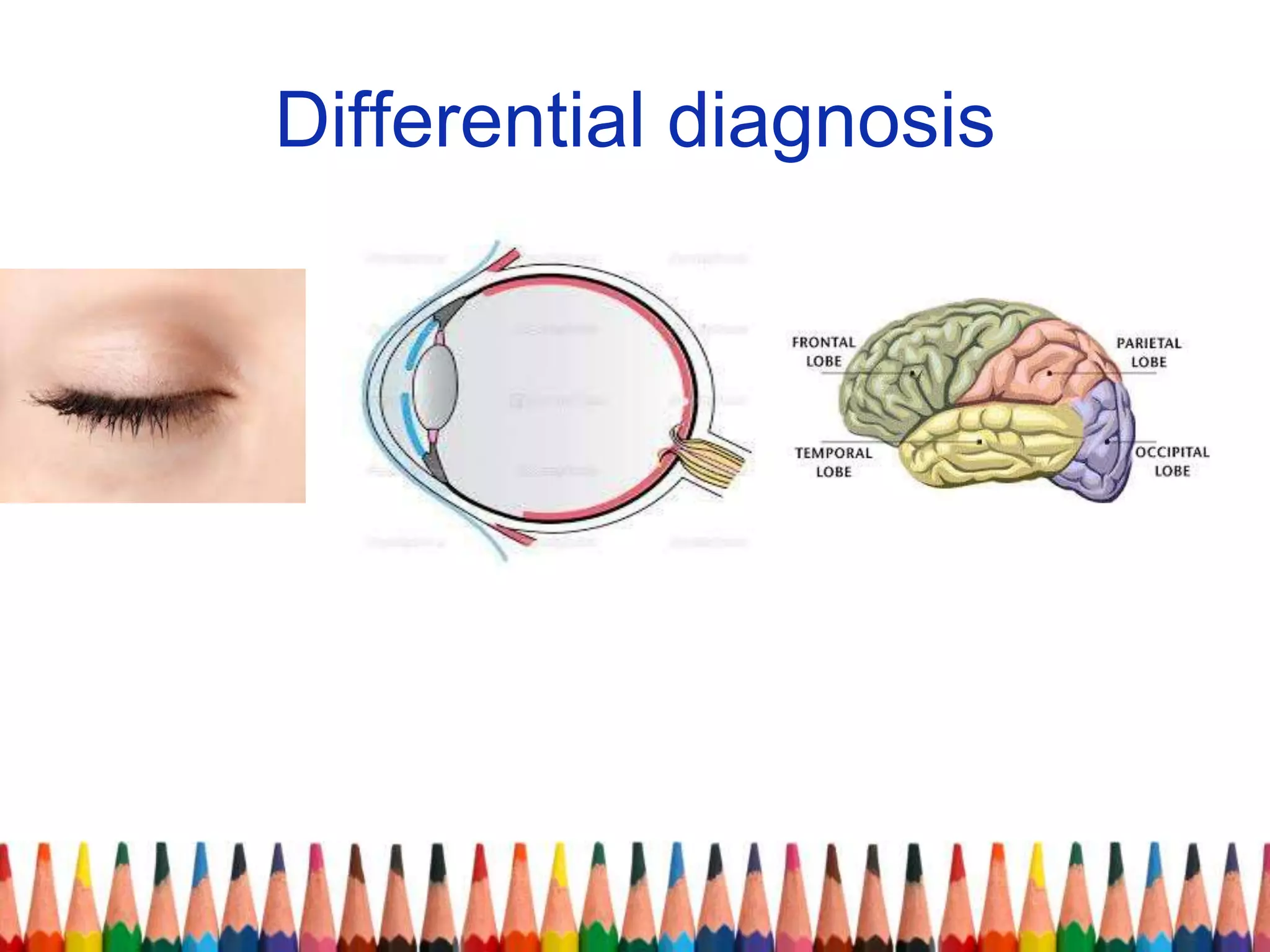 traumatic optic neuropathy | PPTX