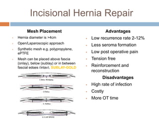 Incisional Hernia | PPTX