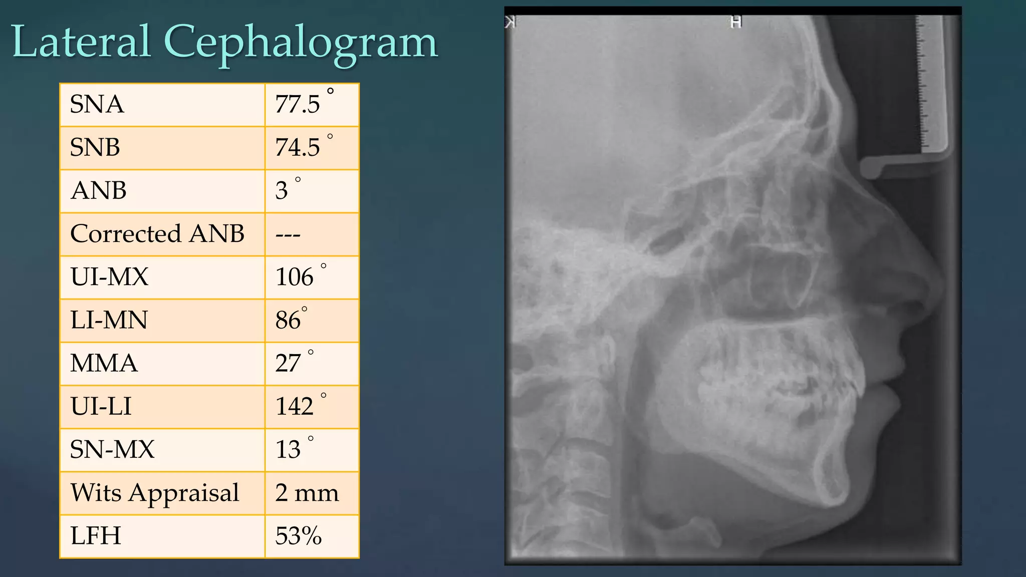 Case presentation | PPTX