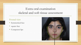 Case presentation | PPTX