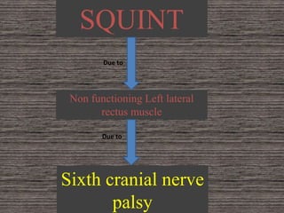 Sixth Nerve Palsy | PPTX