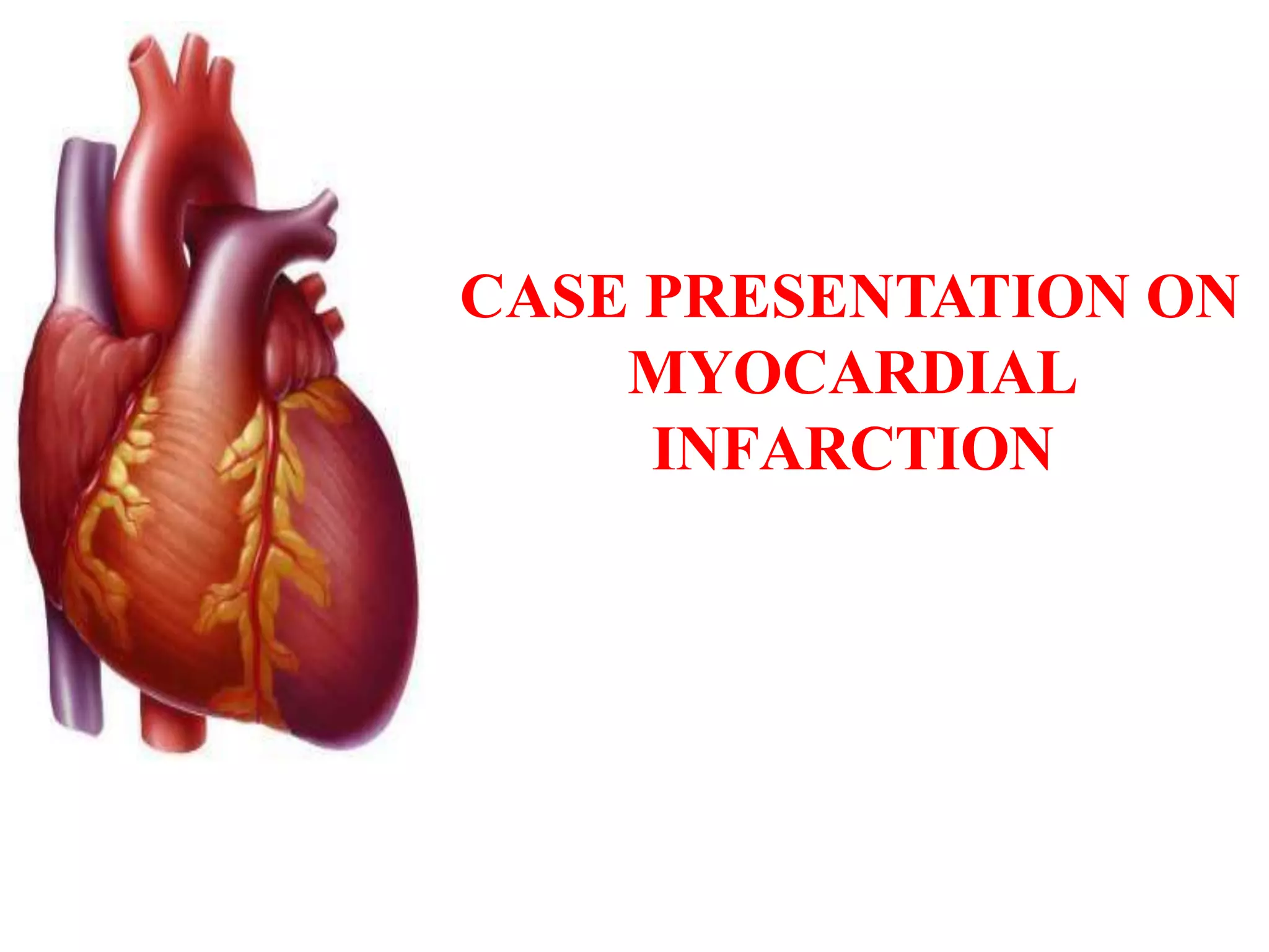 Casepresentation on myocardial infarction | PPTX