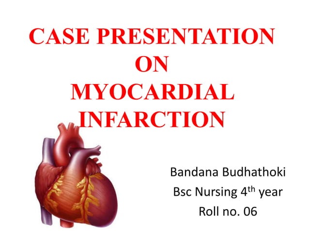 Case presentation on Myocardial Infarction | PPTX