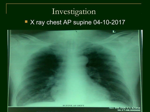 Case presentation (COPD) | PPT