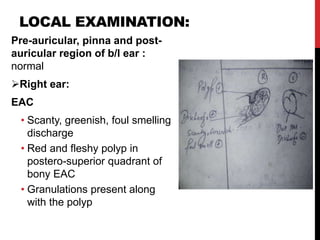 Case presentation | PPTX