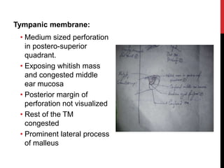 Case presentation | PPTX