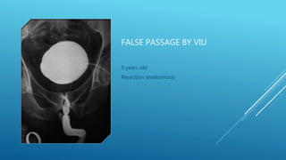 Case presentation | PPT