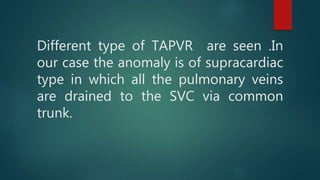 total anomalous pulmonary venous return | PPTX