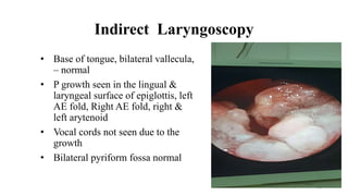 Case presentation- Larynx | PPTX
