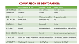 Acute Gastroenteritis with dehydration | PPTX