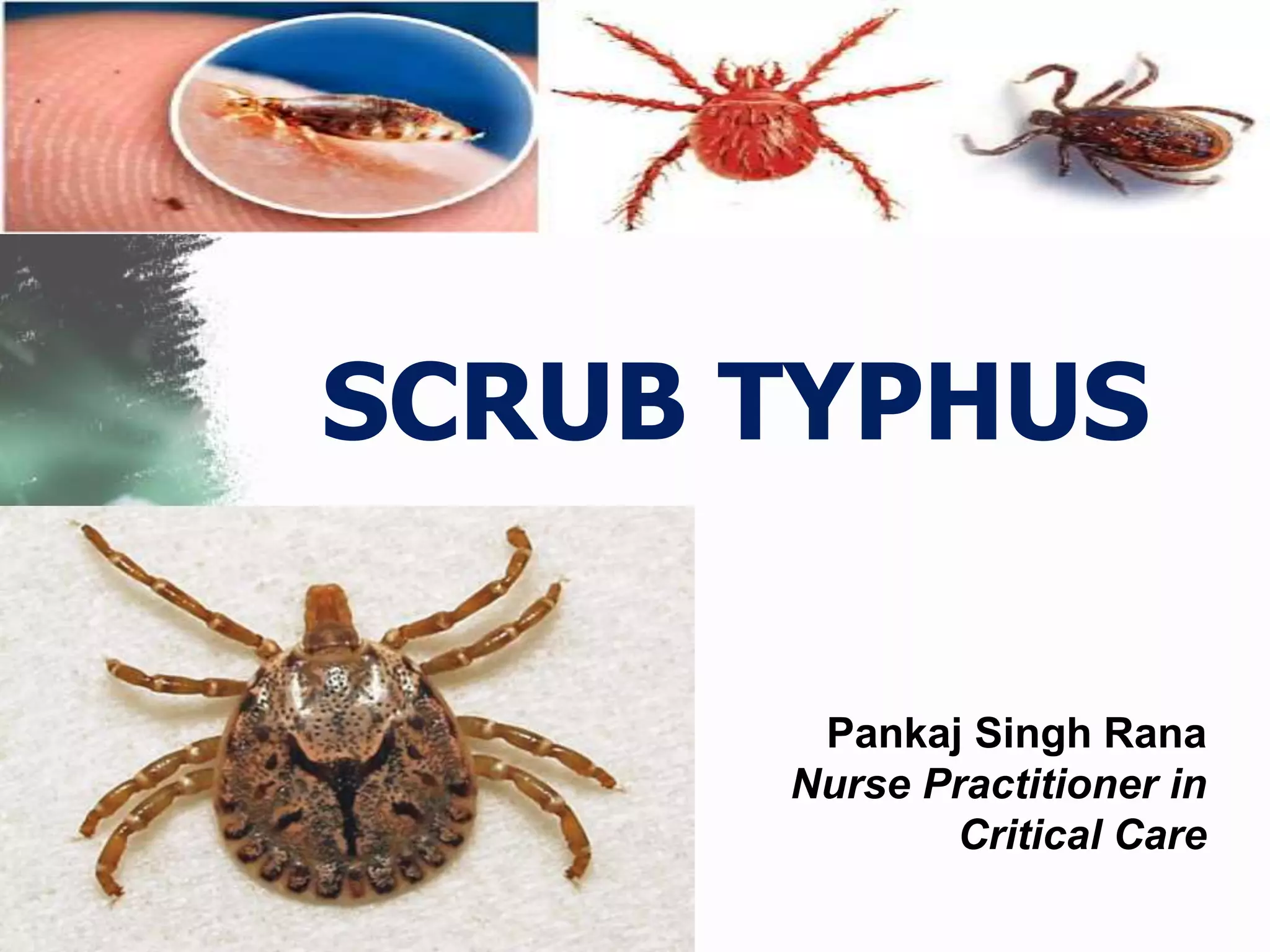scrub typhus | PPTX