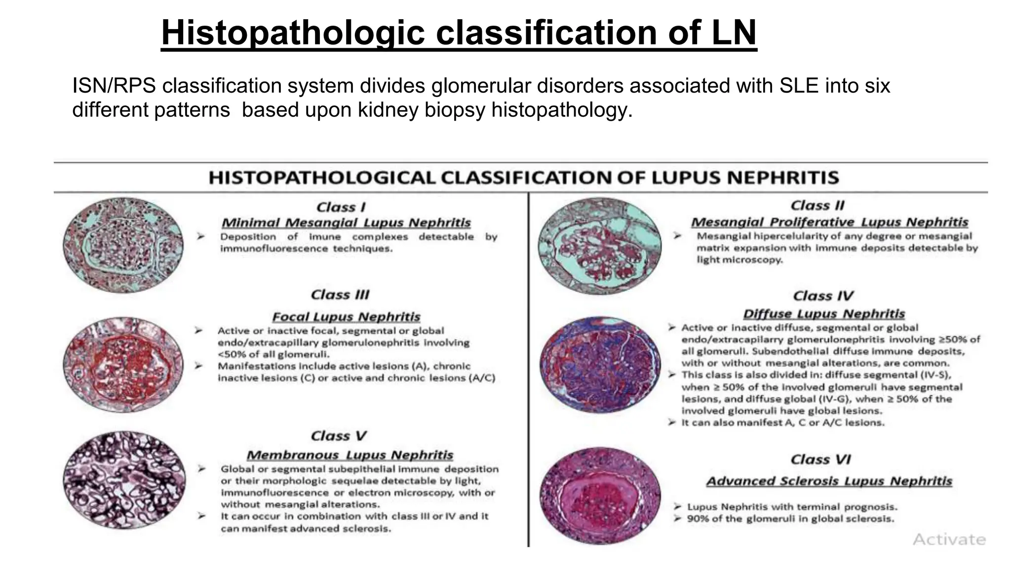 Case Presentation.pptx Lupus nephritis is inflammation and damage in ...