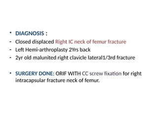 Case presentation.pptxneck of femur fracture without dnvd | PPTX