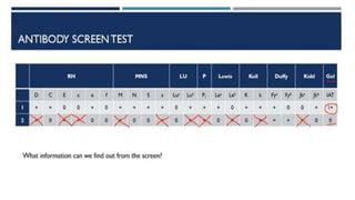 Case presentation on Antibody screening- how to solve 3 cell and 11 ...