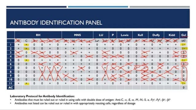 Case presentation on Antibody screening- how to solve 3 cell and 11 ...